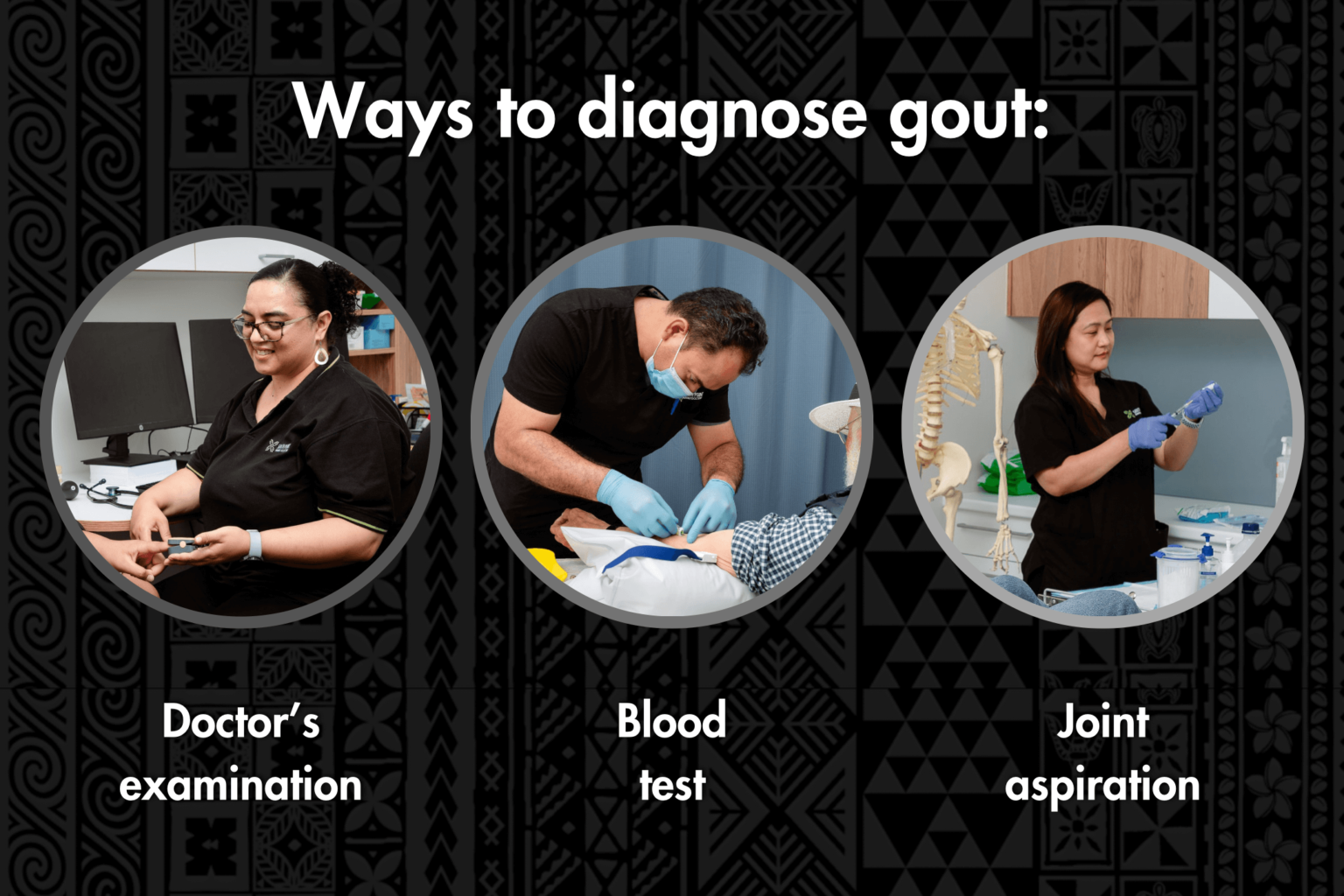 Gout: important things to know